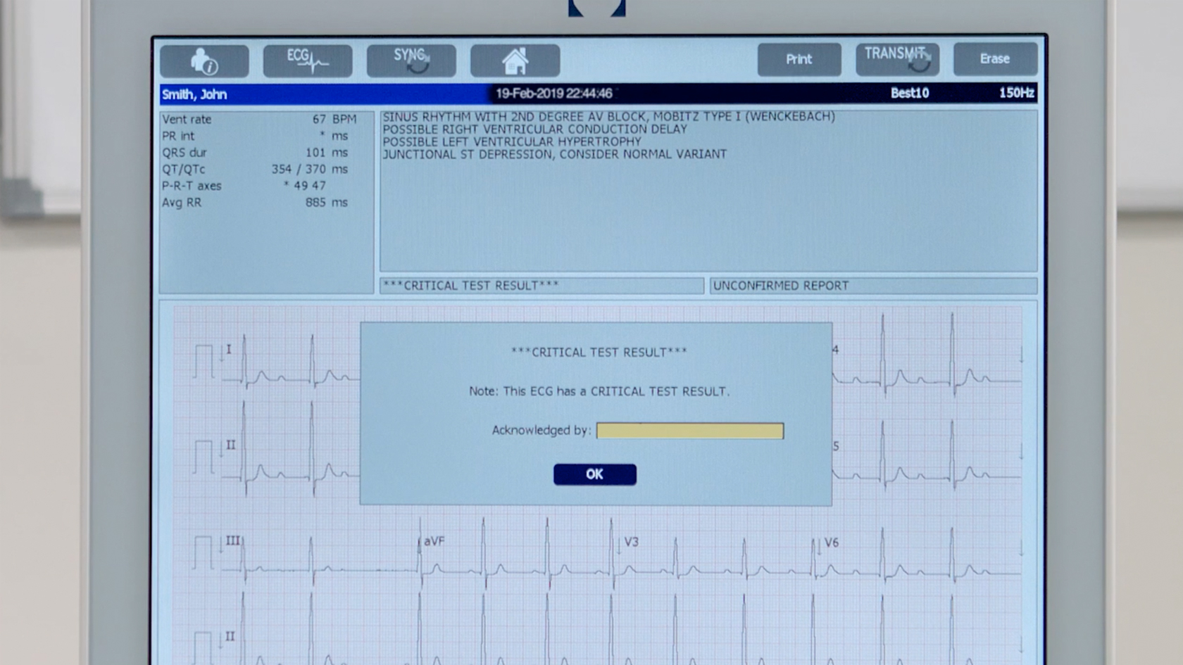 ELI 380 ECG Resting Electrocardiograph Hillrom, 03/15/2024